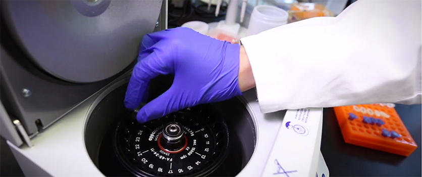 Physician-Scientist Training Program: Department of Pathology: Feinberg ...